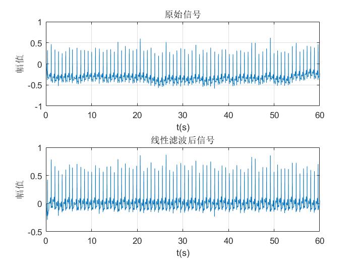 基于MATLAB实现ECG心电信号处理_matlab,生产心电图-CSDN博客