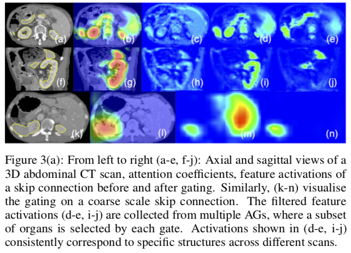 Attention U-Net: Learning Where to Look for the Pancreas_attention u-net期刊-CSDN博客