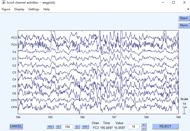 针对Matlab脑电数据EEG处理、 eeglab工具箱、Neuracle数据采集操作要点事项_博瑞康脑电采集教程-CSDN博客