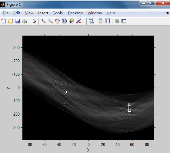 霍夫变换（Hough Transform）的原理以及代码（Matlab&C）实现_hough变换 c语言-CSDN博客