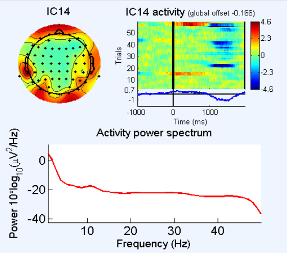 针对Matlab脑电数据EEG处理、 eeglab工具箱、Neuracle数据采集操作要点事项_博瑞康脑电采集教程-CSDN博客