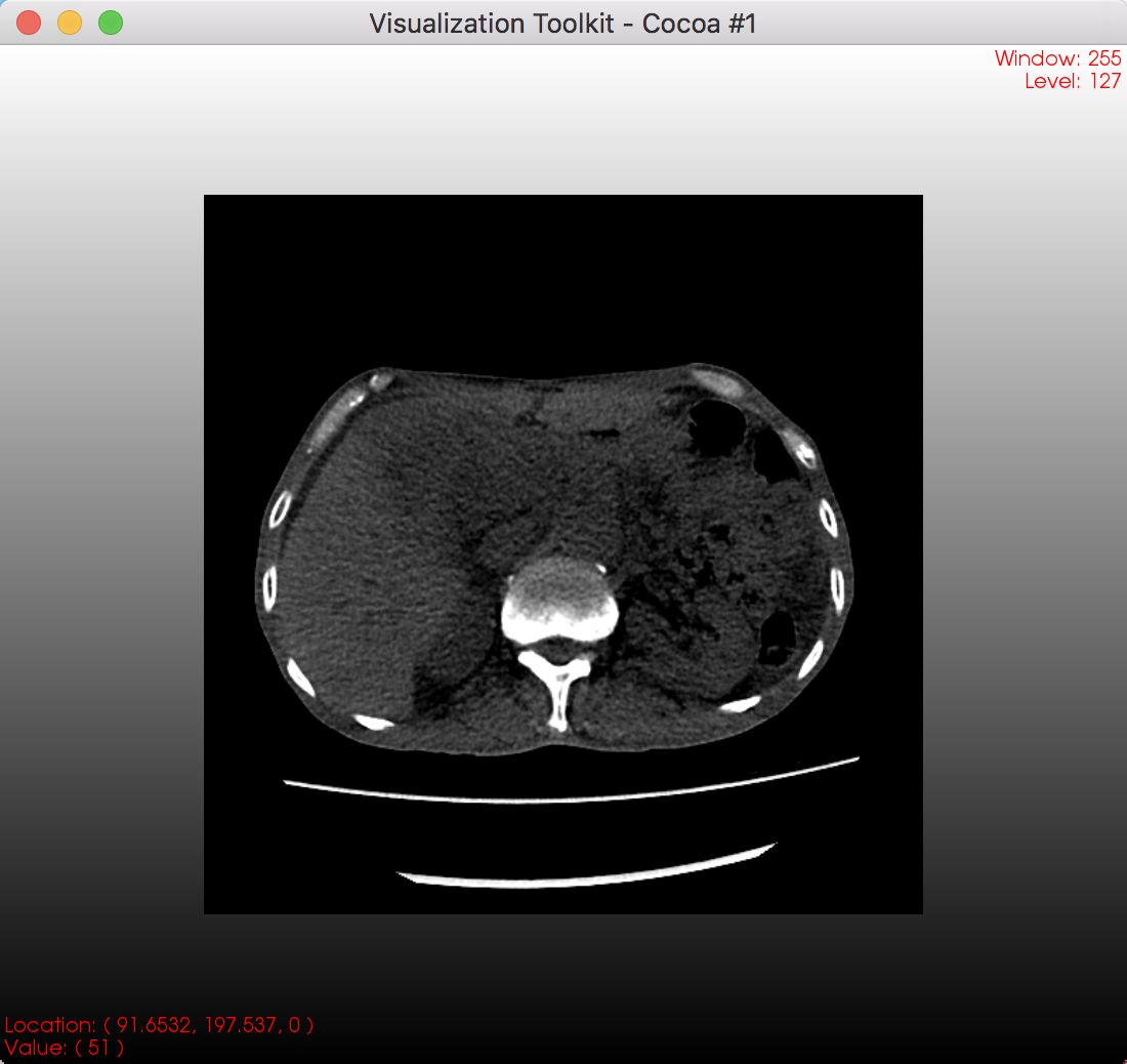 VTK 鼠标交互实时显示窗口内图像的像素坐标（二维图像）_vtk中显示点坐标-CSDN博客