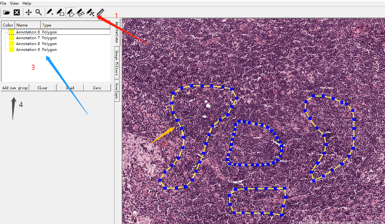 全视野数字切片（whole slide images, WSIs）的预处理-CSDN博客