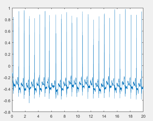 Matlab中wfdb库安装并使用_waveform database wfdb matlab-CSDN博客