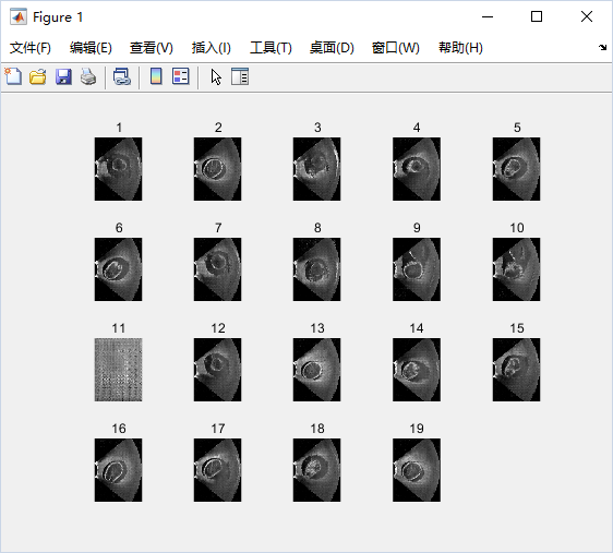 Matlab批量将.nii文件保存为.mat文件_nii文件可以转为mat格式吗-CSDN博客