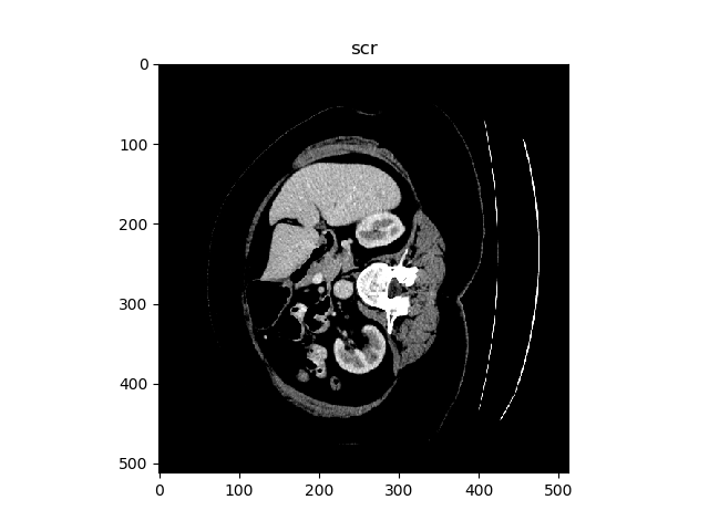 Python图像水平翻转python Matplotlib读取图片翻转 Csdn博客 3068