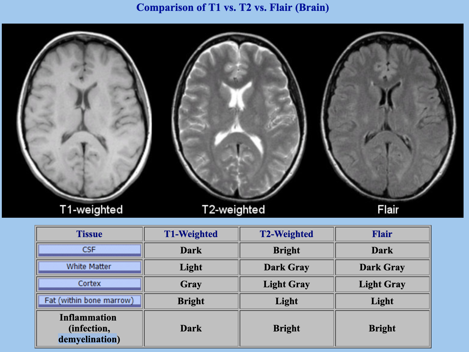 [医学影像基础] 脑部MRI影像_hellopipu的博客-CSDN博客