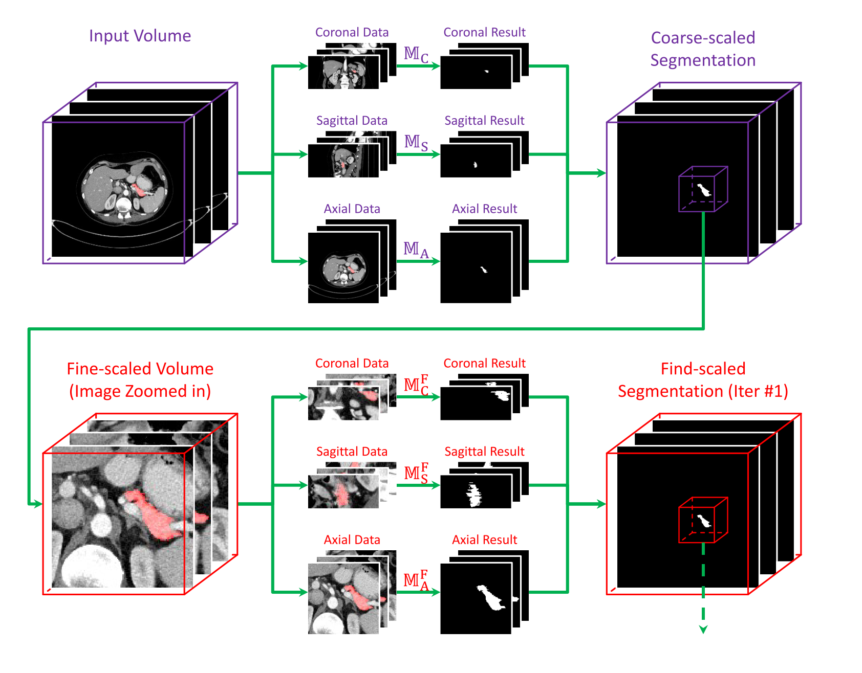 【论文阅读】Pancreas Segmentation in Abdominal CT Scan: A Coarse-to-Fine ...