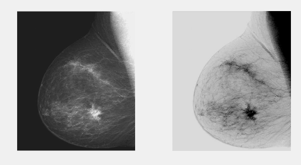 图像处理 灰度变换，图像反转，对数变换，幂次变换，位图切割，直方图显示，直方图均衡，直方图匹配 （数字图像处理matlab实现 ）线性灰度变换、对数变换、灰度切割和位图切割实例直方图
