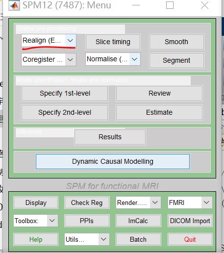 SPM12入门案例1_matlab的spm中check reg-CSDN博客