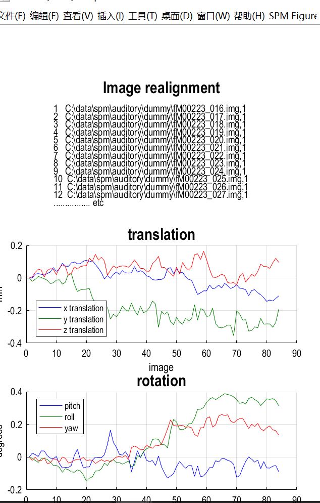 SPM12入门案例1_matlab的spm中check reg-CSDN博客
