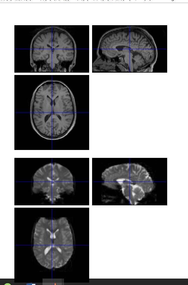 SPM12入门案例1_matlab的spm中check reg-CSDN博客