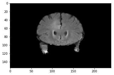 [医学图像预处理1]使用nibabel和SimpleITK读取处理Nifiti文件(MRI图像)_nibabel 读取nii文件到底是x,y,z还是其他的顺序-CSDN博客