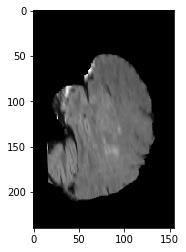 [医学图像预处理1]使用nibabel和SimpleITK读取处理Nifiti文件(MRI图像)_nibabel 读取nii文件到底是x,y,z还是其他的顺序-CSDN博客