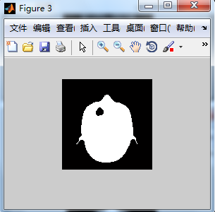 MATLAB形态学图像处理_matlab strel('disk',5)-CSDN博客