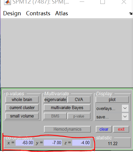 SPM12入门案例1_matlab的spm中check reg-CSDN博客