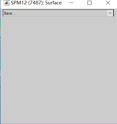 SPM12入门案例1_matlab的spm中check reg-CSDN博客