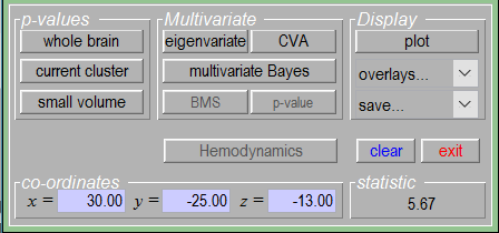 SPM12入门案例1_matlab的spm中check reg-CSDN博客