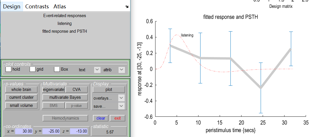 SPM12入门案例1_matlab的spm中check reg-CSDN博客