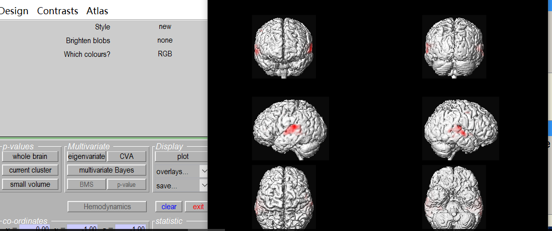 SPM12入门案例1_matlab的spm中check reg-CSDN博客