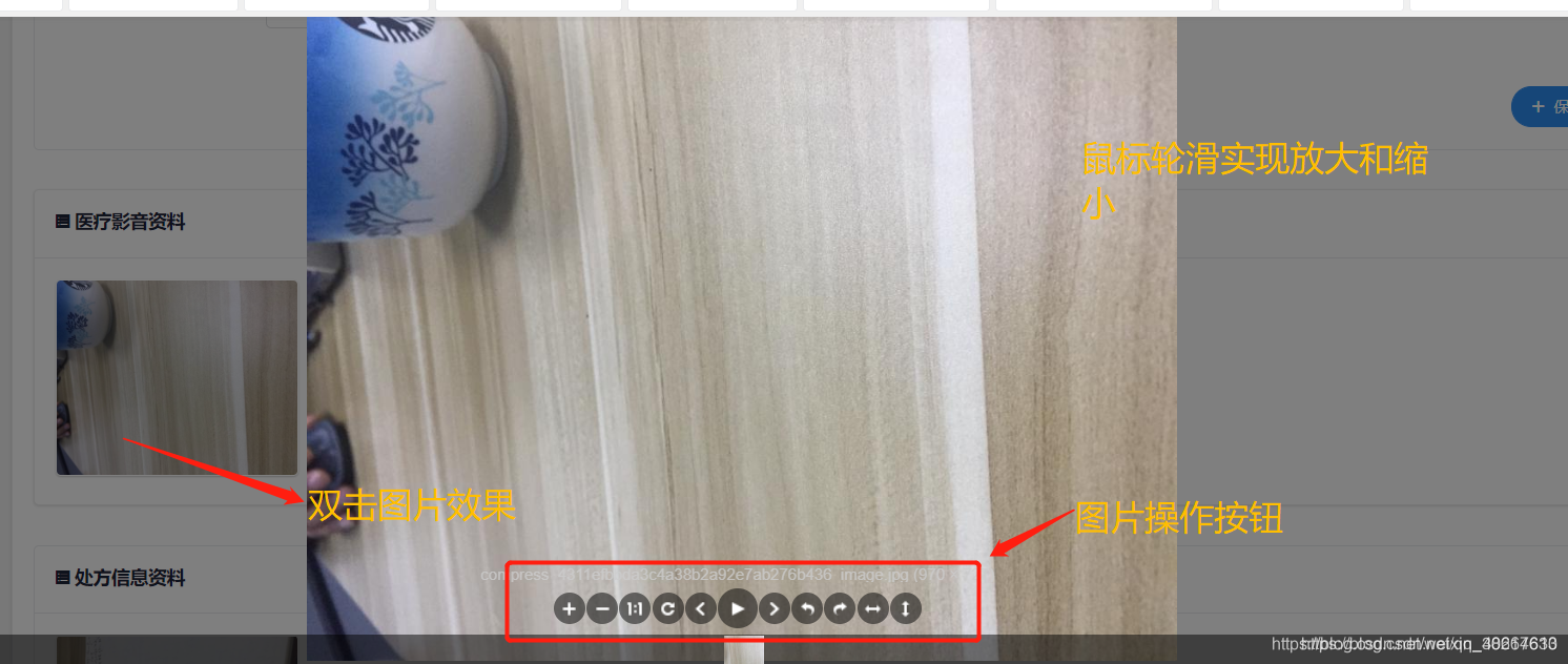 Vue点击放大图片功能实现【超简单!】vue 点击放大 Csdn博客 9483