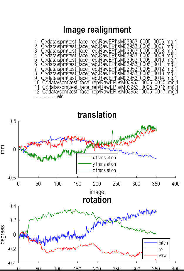 SPM12入门案例2-CSDN博客