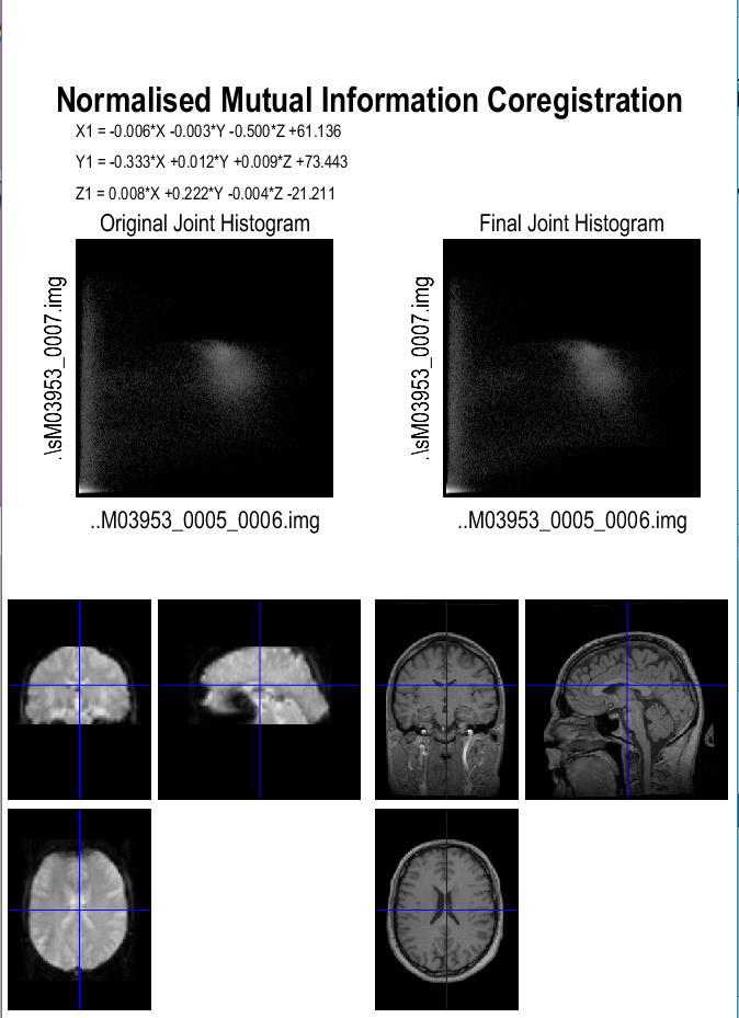 SPM12入门案例2-CSDN博客