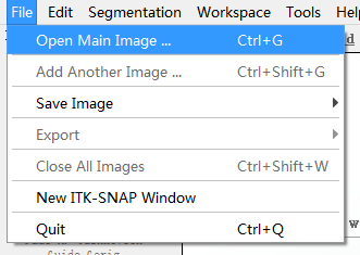 ITK-SNAP使用教程_itksnap如何保存图片-CSDN博客