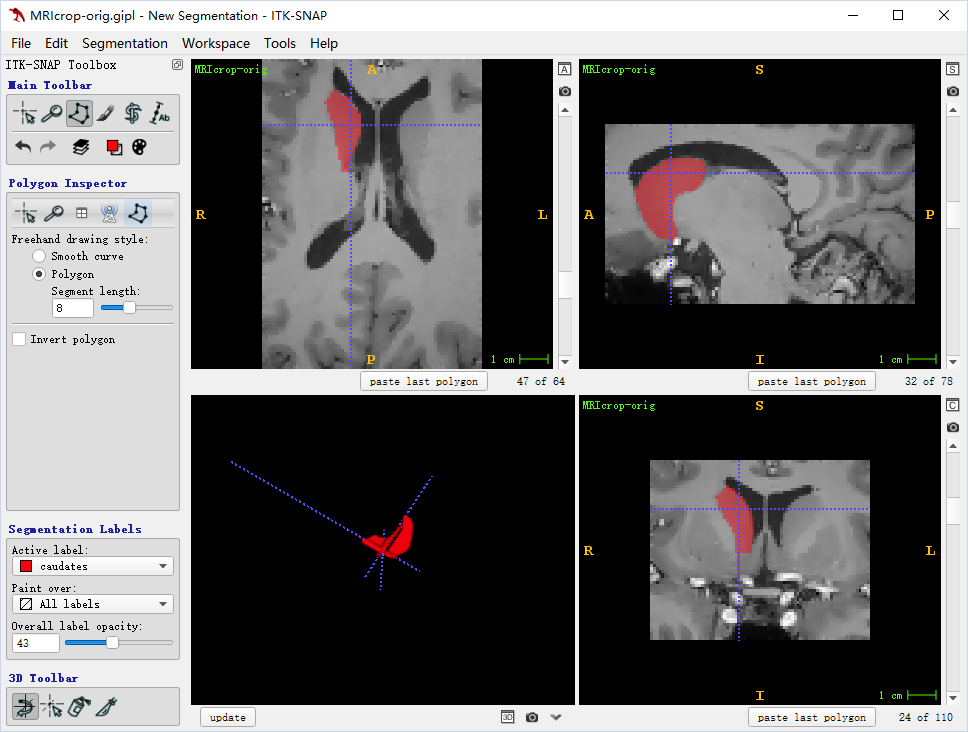 ITK-SNAP使用教程_itksnap如何保存图片-CSDN博客