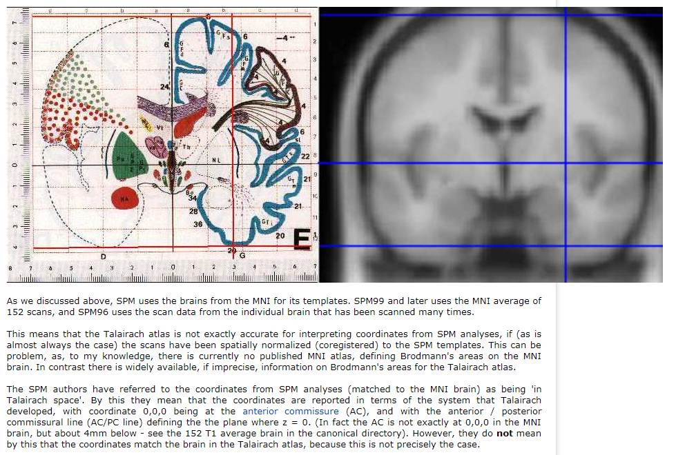 Talairach 和 MNI 坐标转换_只能输入talairach坐标,而不能输入mni坐标-CSDN博客