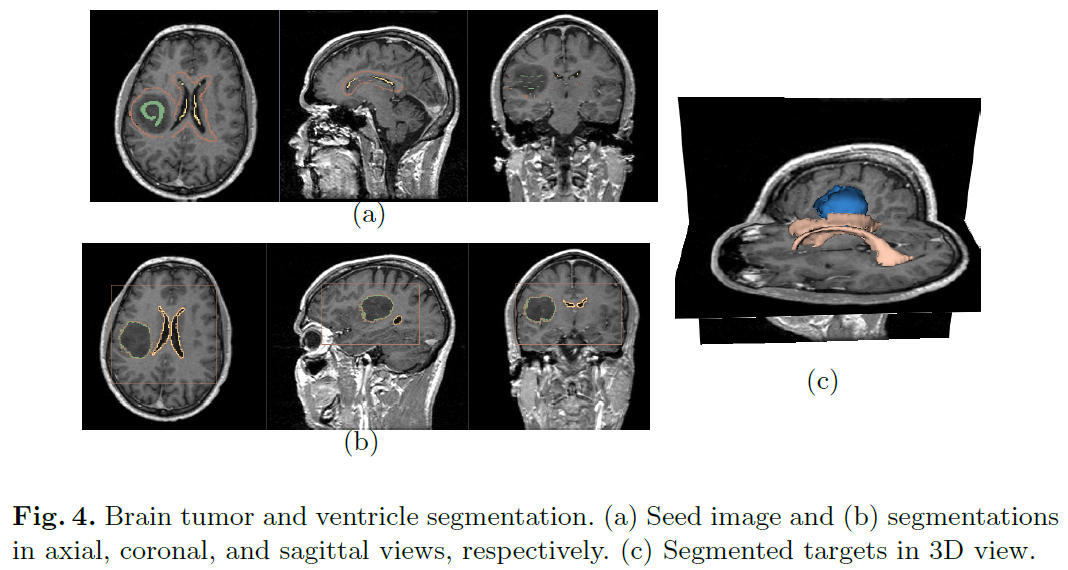 【论文整理】Interactive Segmentation_interactive segmentation of radiance fields-CSDN博客