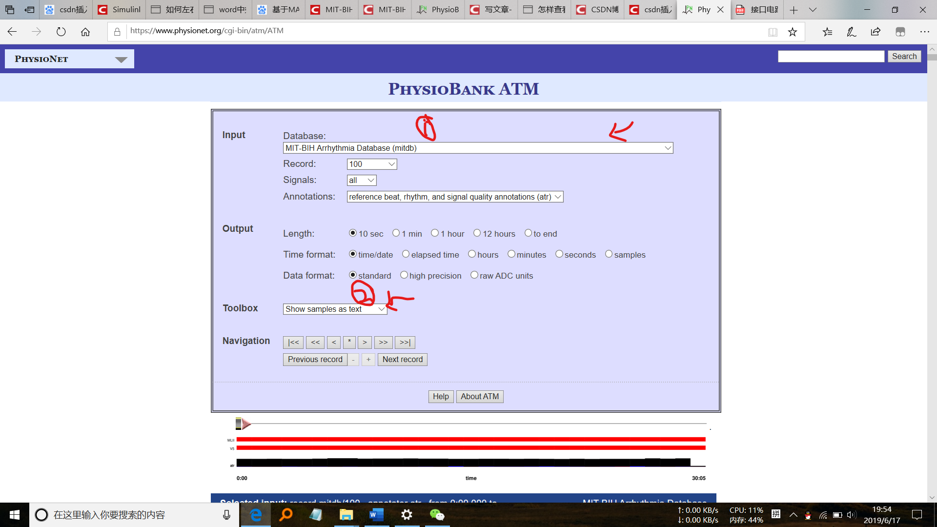 （最简单）从MIT-BIH ECG 心电数据（.txt）详细的下载过程-CSDN博客
