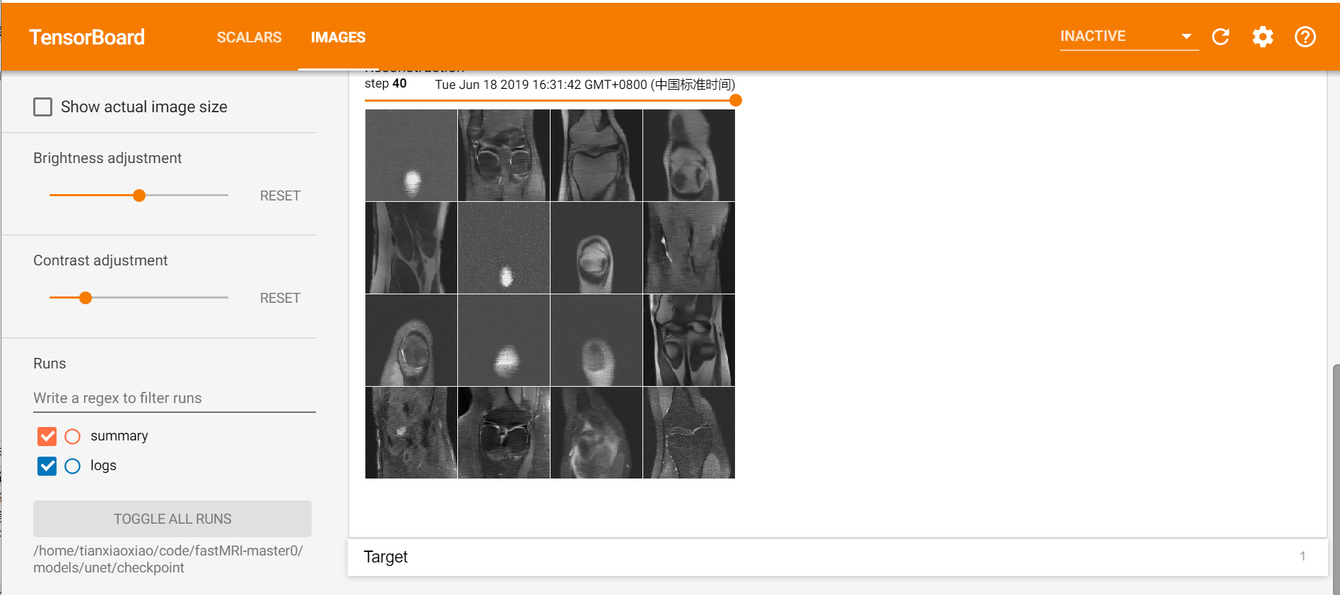fastmri 网络调试（unet）_mri fastai unet-CSDN博客