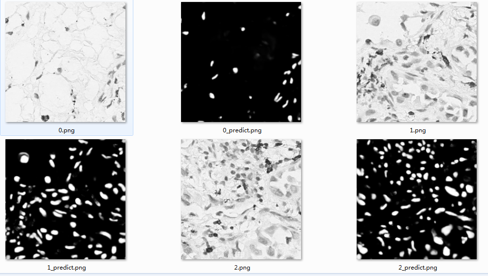 mask-r-cnn，unet，unet++三种算法实现细胞分割的对比心得_unet和mask r-cnn效果对比-CSDN博客
