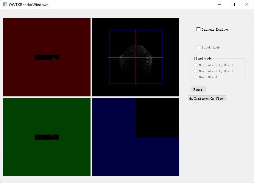 vtk实现MPR、MIP、minIP、aveIP_QQ3508551694-CSDN博客_vtk mpr