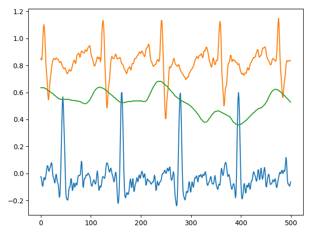 WFDB View ECG Signals - Programmer Sought