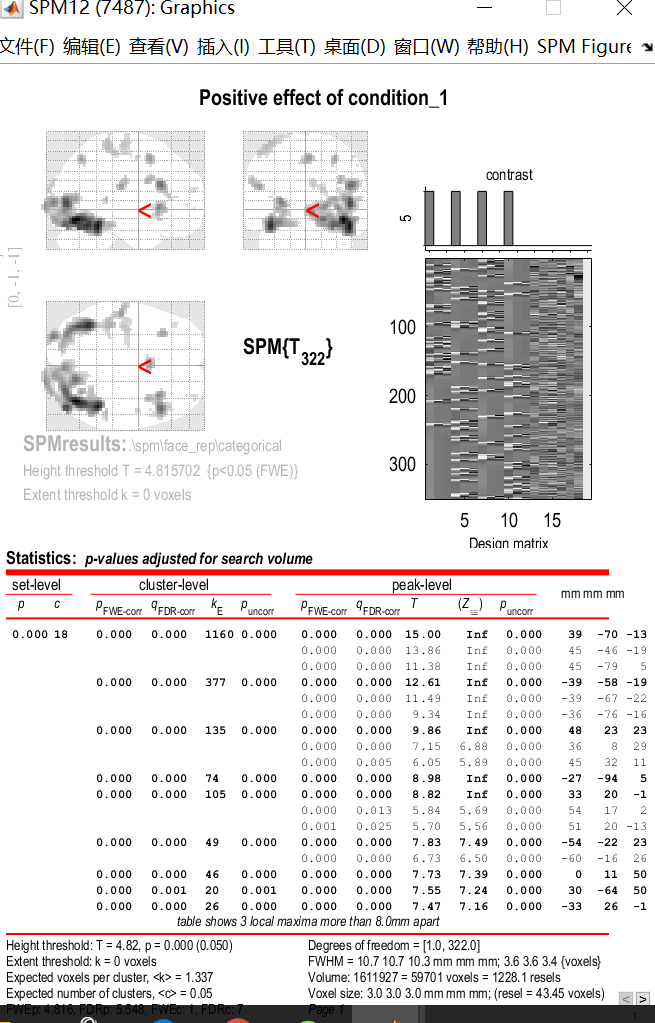 SPM12入门案例2-CSDN博客