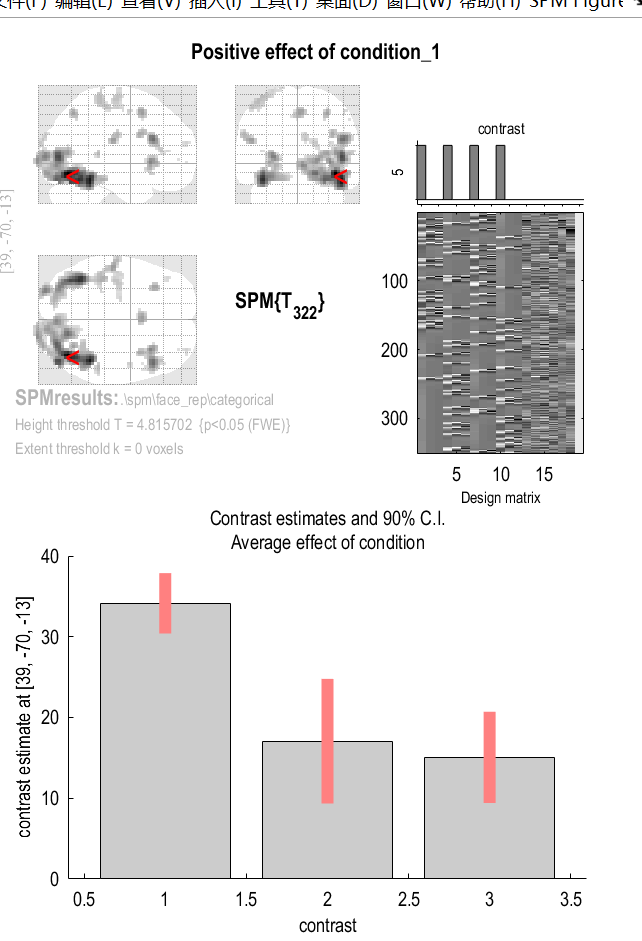 SPM12入门案例2-CSDN博客