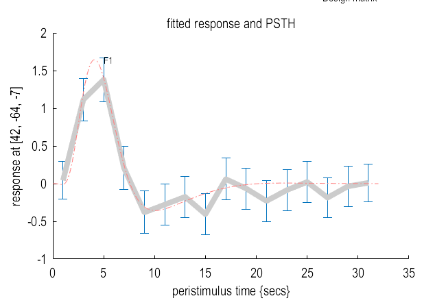 SPM12入门案例2-CSDN博客