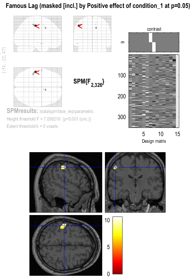 SPM12入门案例2-CSDN博客