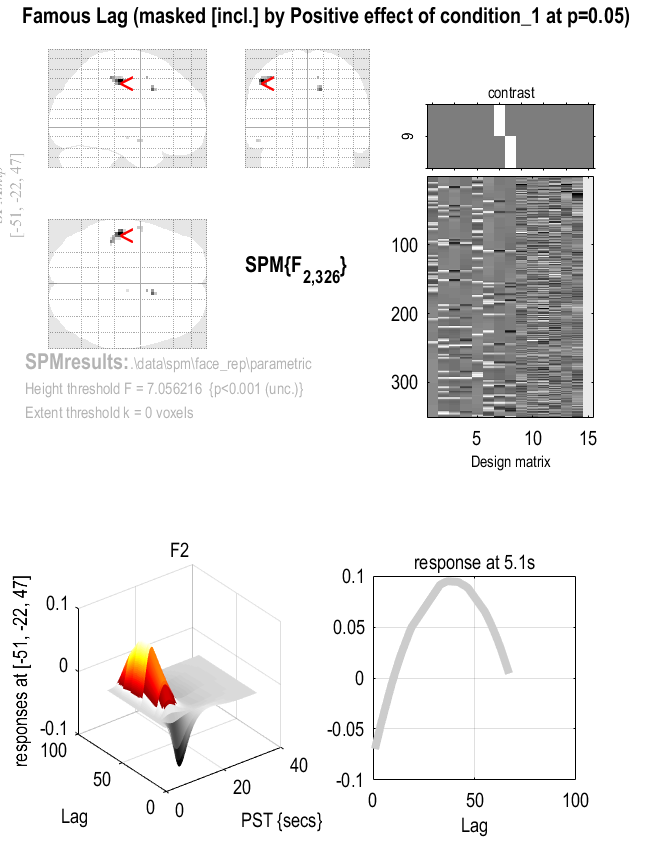SPM12入门案例2-CSDN博客