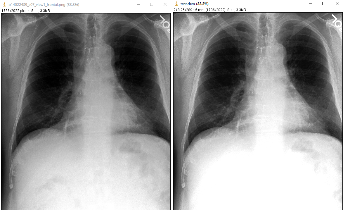 Python 如何替换Dicom医学图像内容 附代码_python dcm修改图像数据-CSDN博客