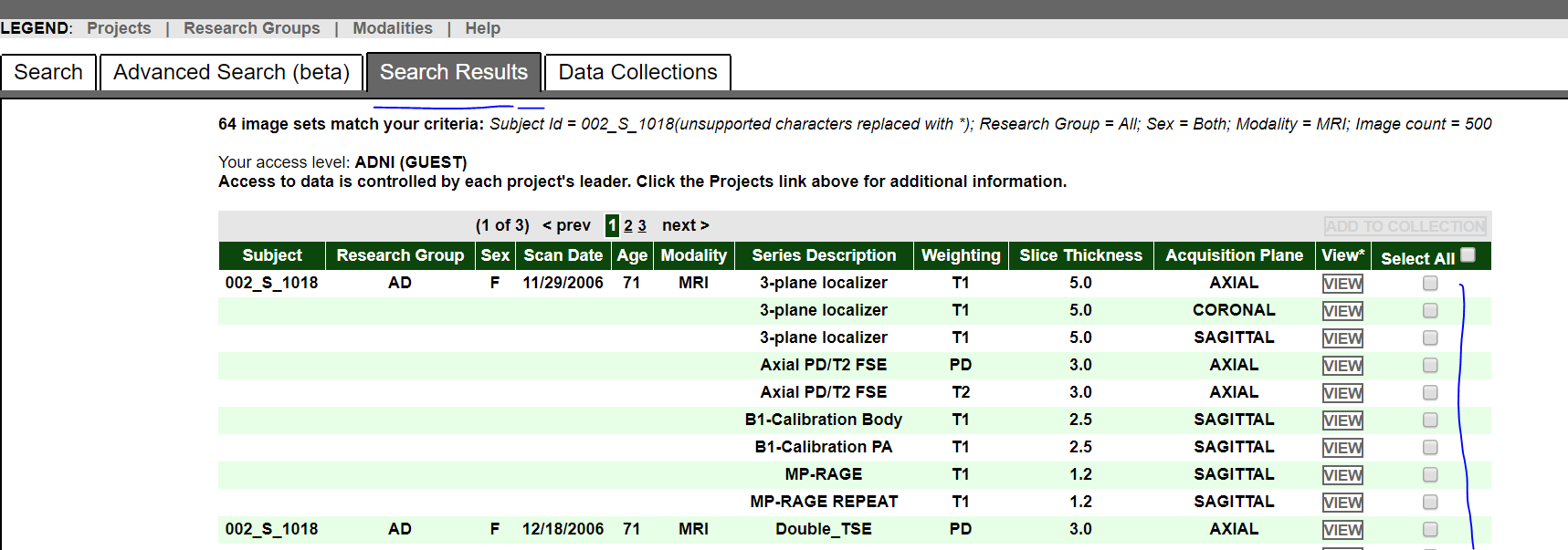 ADNI数据集几个使用小技巧 【1】_qq_27196755的博客-CSDN博客_adni数据库怎么看