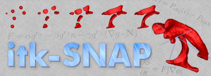 ITK-SANP 使用指南_itk-snap中图像太暗了-CSDN博客