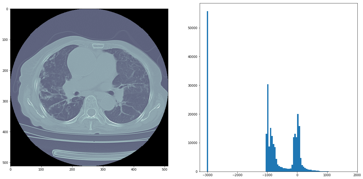 python 可视化 raw，mhd 格式医学图像数据_医学图像raw文件下载-CSDN博客