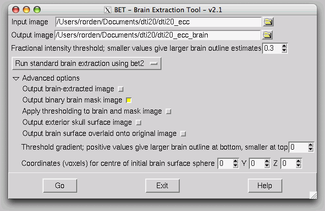 使用fsl处理dti数据(ubuntu16.04)_ubuntu处理dti数据处理总是报错-CSDN博客