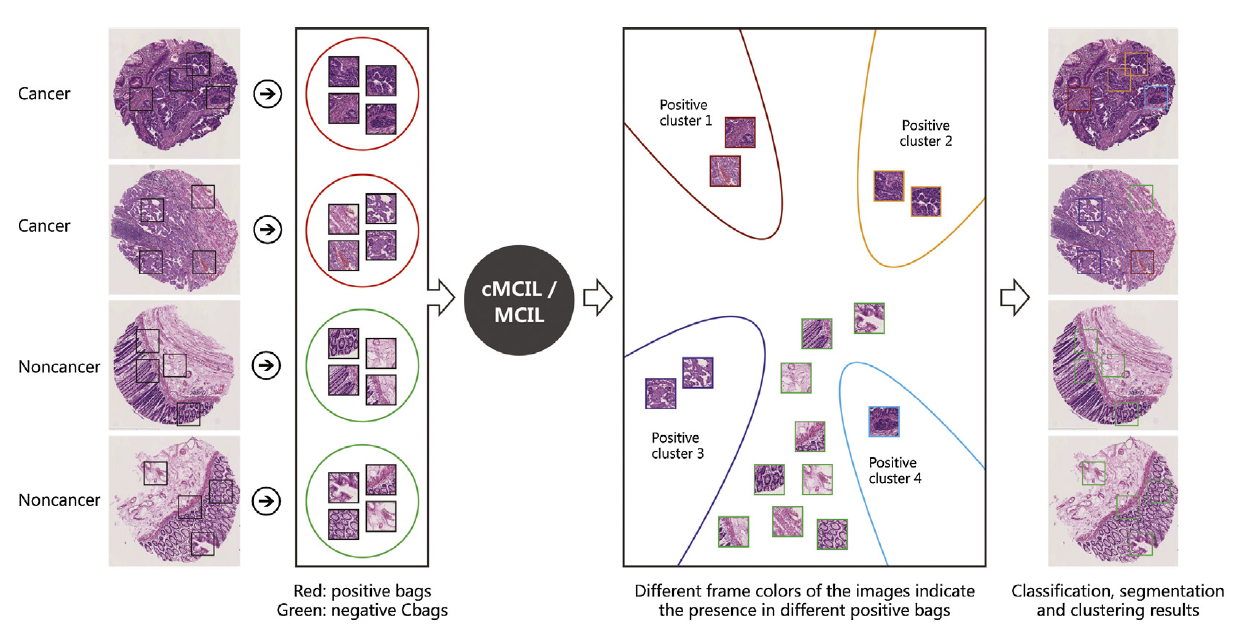 MIA 2018 Weakly supervised histopathology cancer image segmentation and classification（无代码）-CSDN博客