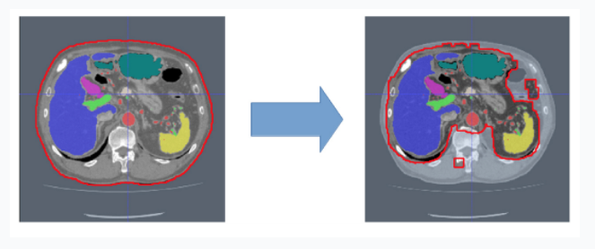【论文阅读】Abdominal multi-organ segmentation with organ-attention networks ...
