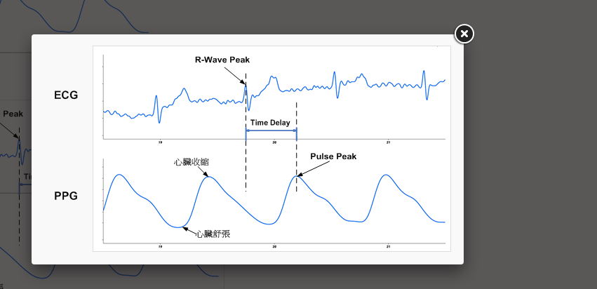 ECG/PPG量测解决方案_ecg ppg 方案-CSDN博客