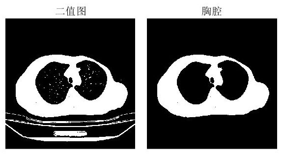 （图像分割）MATLAB胸部CT肺质提取_基于matlab的肺部ct图像分割-CSDN博客